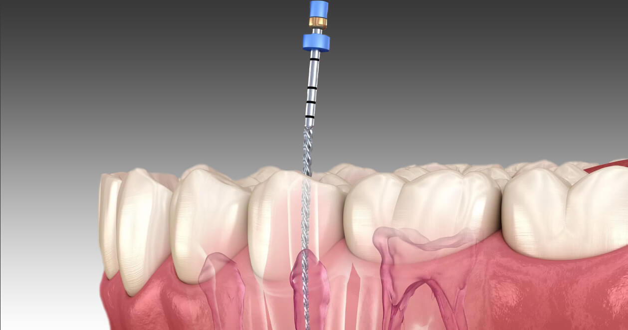 Dental Clinic in Turkey Istanbul | Aurea Dental