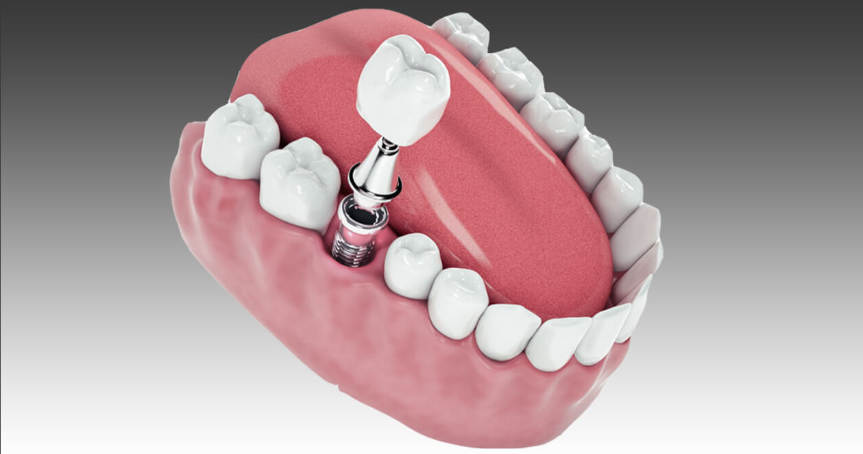 Dental Clinic in Turkey Istanbul | Aurea Dental